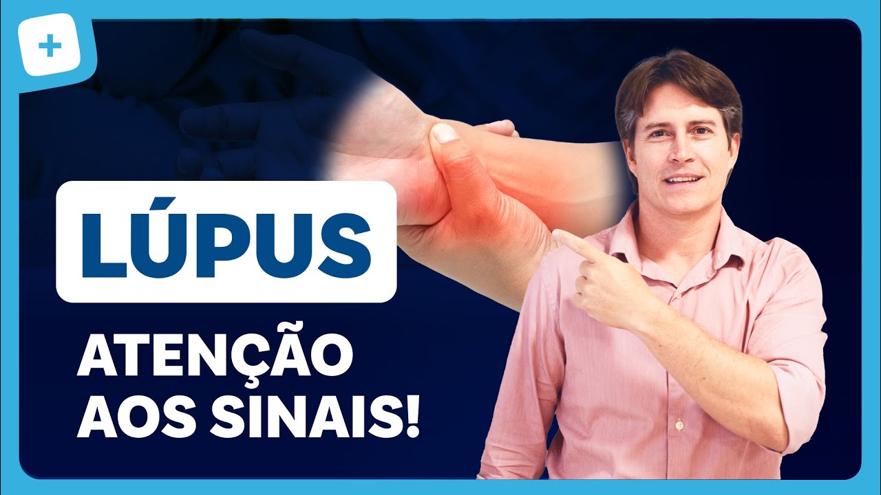 o que é lúpus e quais são os sintomas Archives - Saude Bem Estar BR o que é lúpus e quais são os sintomas Archives - Saude Bem Estar BR